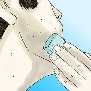 Alum Block Acne | Absolute Shaving 2024