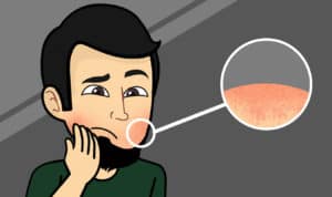 The Most Common Beard Problems and How to Fix Them